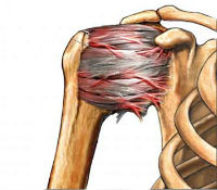 Shoulder Pain - Muscle & Joint Clinic - San Rafael Chiropractor